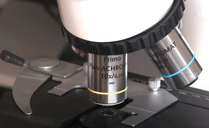 (VIDEO) Así se ve un glóbulo blanco humano persiguiendo a una bacteria